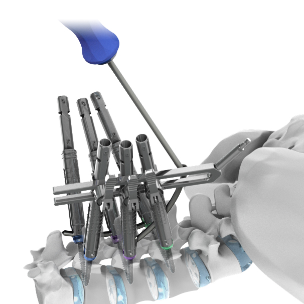 Perfix MIS™ (by U&I CORPORATION)