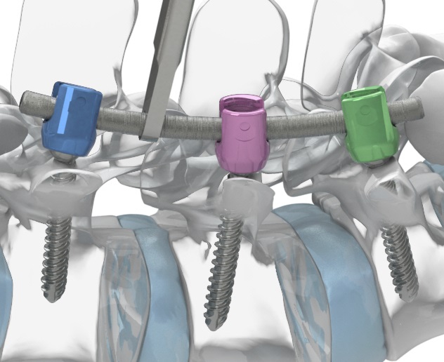 ANAX 5.5™ (by U&I CORPORATION)